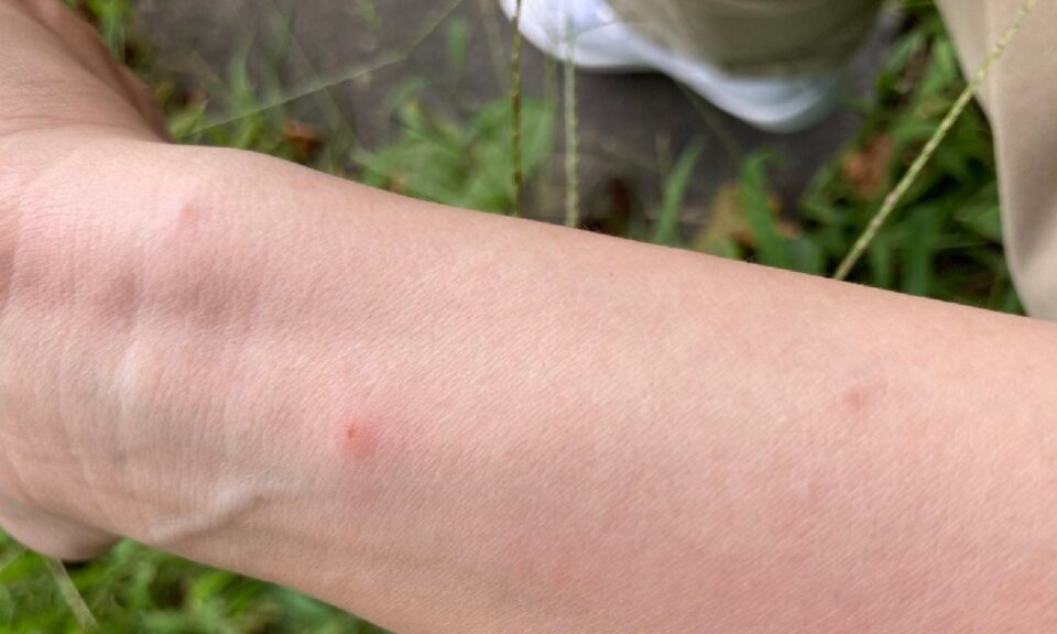 How to Survive Mosquito Season in Japan: Prevention & Remedies